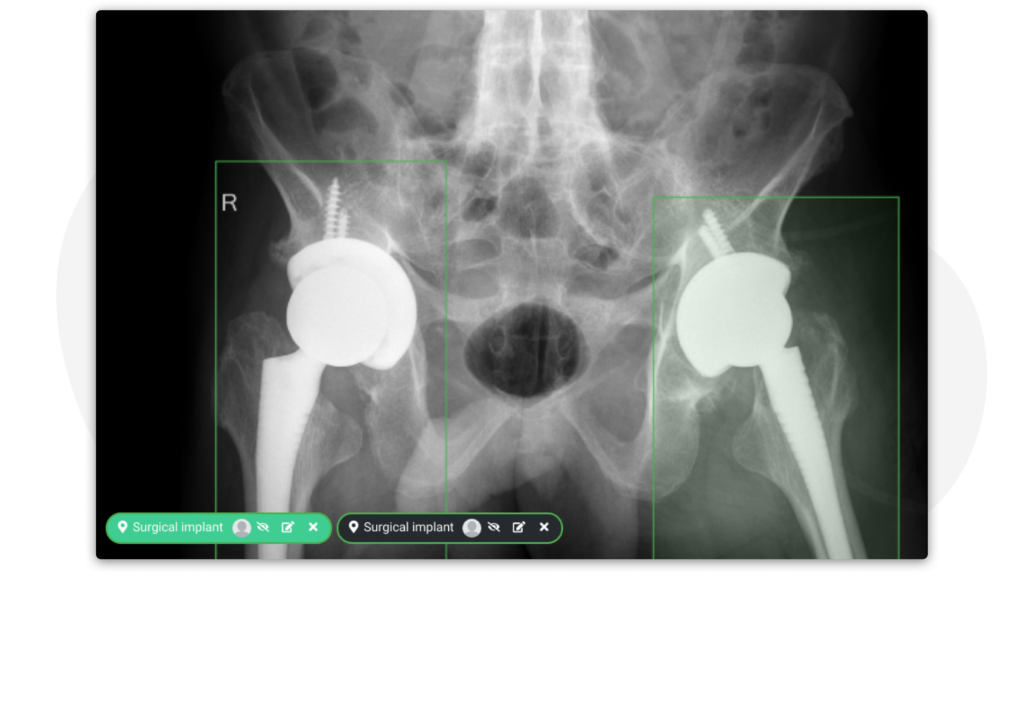 A Data Platform for Medical AI that enables building high-quality datasets and algorithms with ...