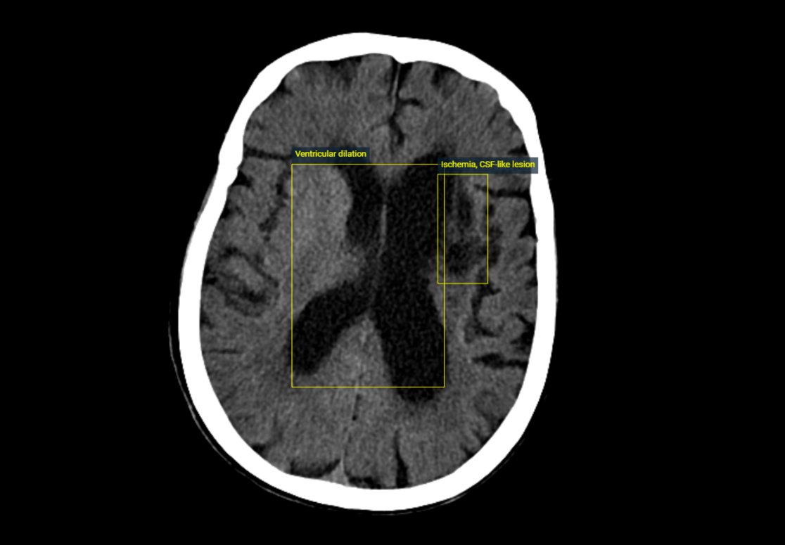 VinDr | Solutions for medical data