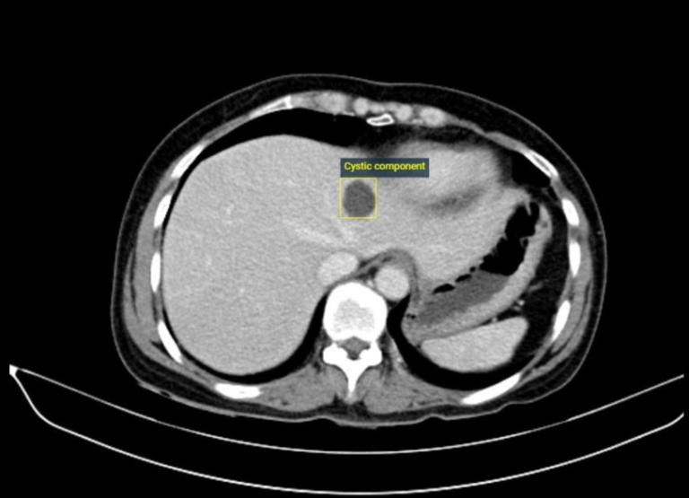 VinDr | Solutions for medical data