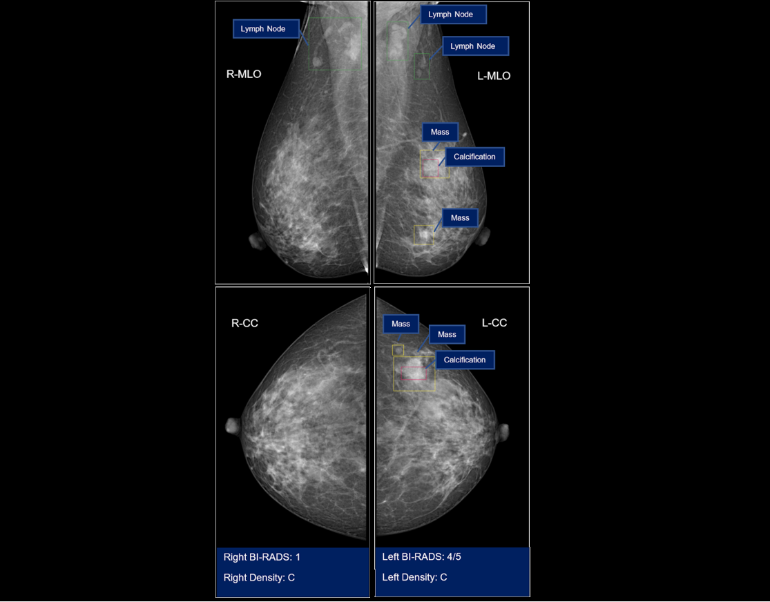 VinDr | Solutions for medical data