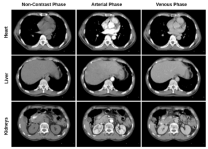 VinDr-Multiphase: A Benchmark Dataset for Phase Recognition in Abdominal Contrast-Enhanced CT ...