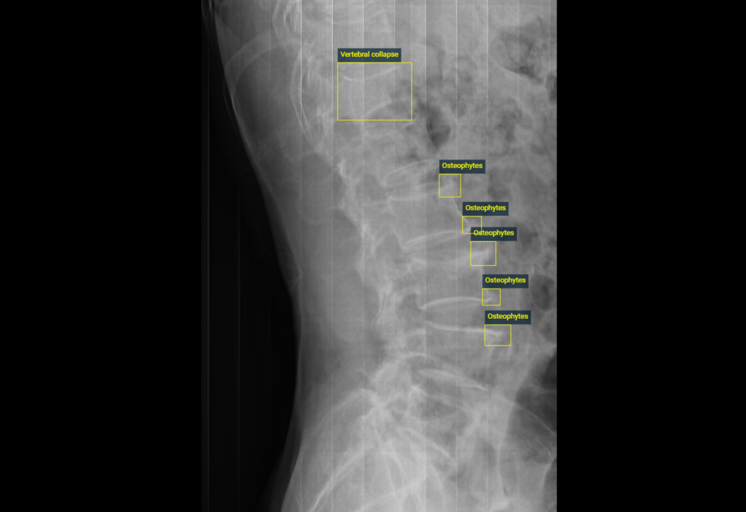 VinDr | Solutions for medical data