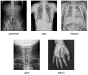 VinDr-BodyPartXR: An open dataset for Classification of Body Parts from DICOM X-ray Scans | VinDr